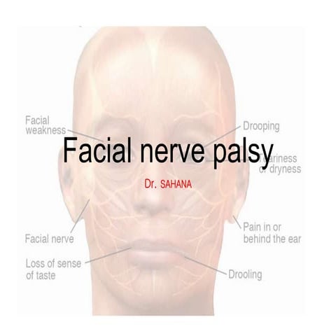 Facial nerve palsy.7th cranial nerve of the system | PPTX