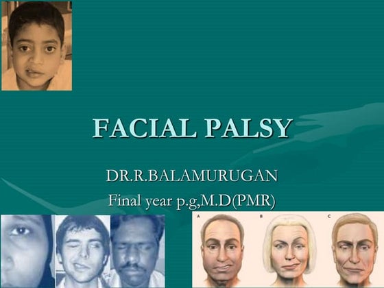 facial nerve examination | PPT