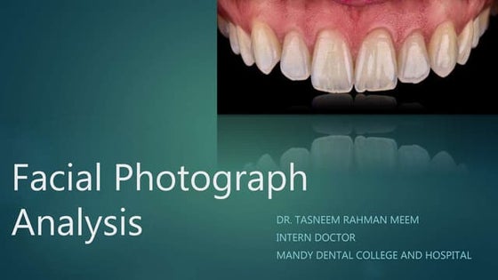 Clinical facial analysis (cfa) for orthodontists | PPTX | Dental Health ...