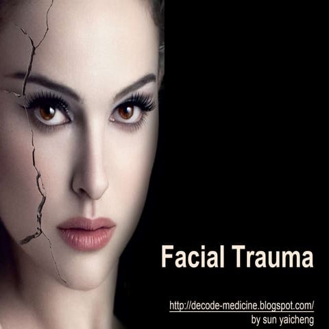 Facial Trauma | PPTX