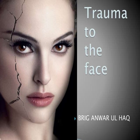 Facial trauma and oroantral fistula | PPTX