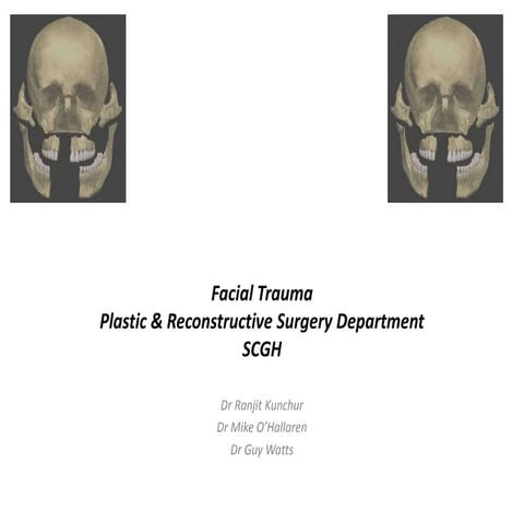 Facial trauma | PPTX