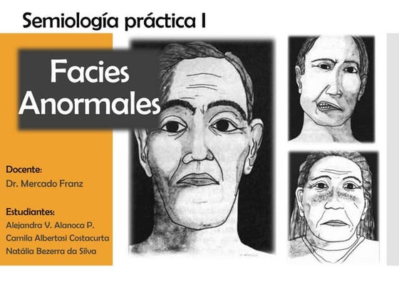 Semiologia Médica - Facies | PPT