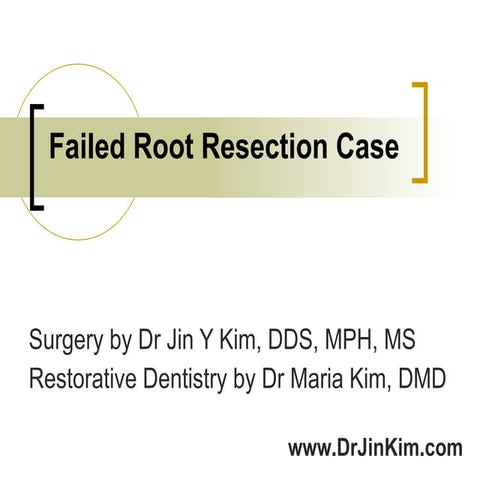 Failed root resection case | PPT