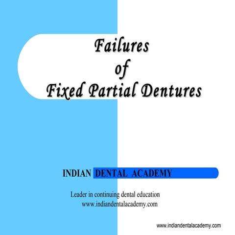 Failures of FPD / cosmetic dentistry courses | PPT