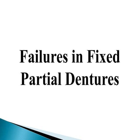 Failures in fpd | PPT