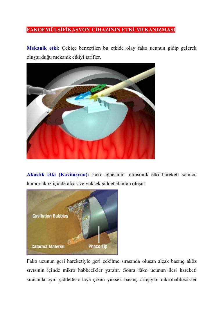 Fako fako cihazinin etki mekanizmasi