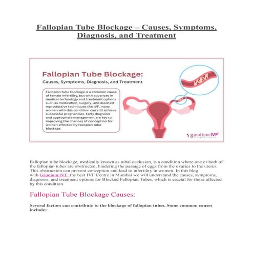 Fallopian Tube Blockage- Causes, Symptoms | PDF