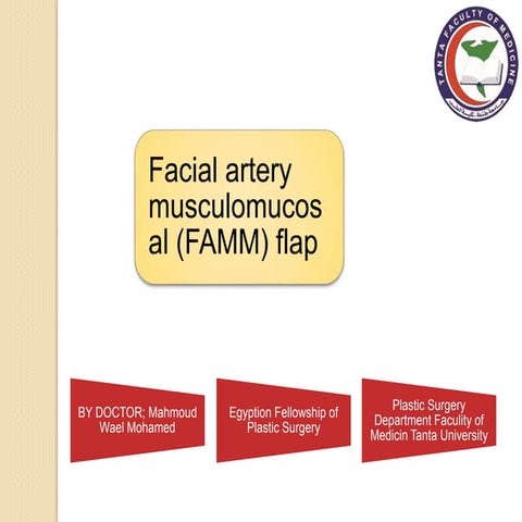 Facial -Artery -musclo -mucosal -Flap presntion | PPTX
