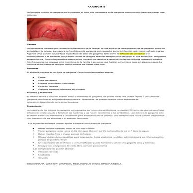 Presentación Faringitis | PPTX