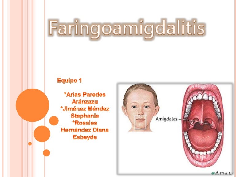 Faringoamigdalitis