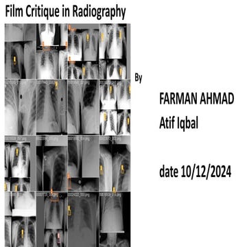 image critique in radiography by Atif | PDF
