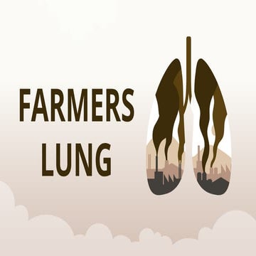 farmers lung etiology diagnosis and treatment -jila.pptx