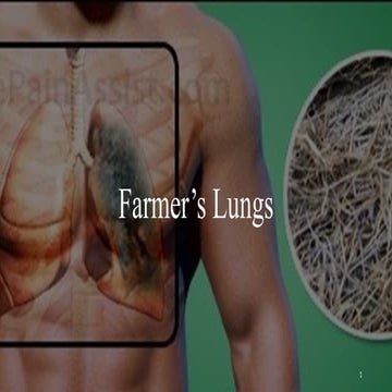 Farmers lungs:Occupational lungs disease | PPTX