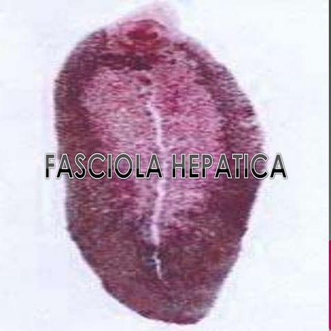 Fasciola hepatica | PPTX