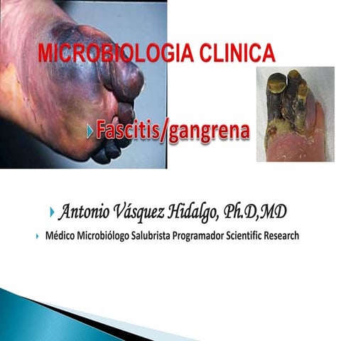 Fascitis gangrena | PPTX