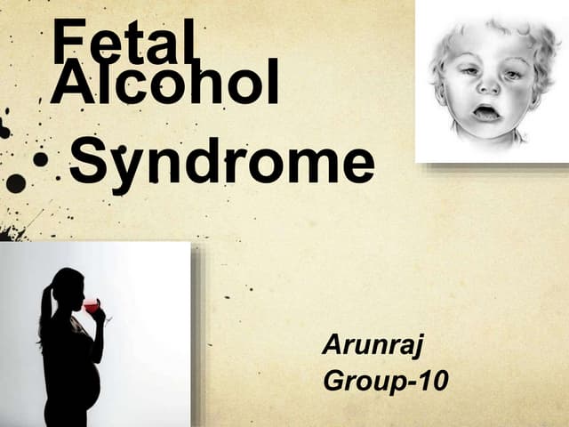 Fetal alcohol syndrome PPT.pptx