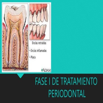 FASE I DE TRATAMIENTO PERIODONTAL.pptx