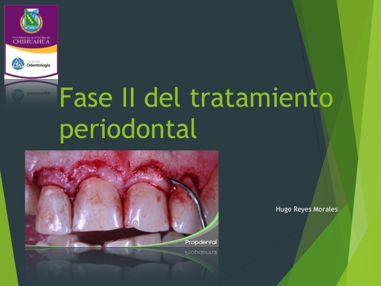 Fase 2 Tratamiento Periodontal