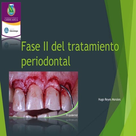 Fase 2 Tratamiento Periodontal | PDF
