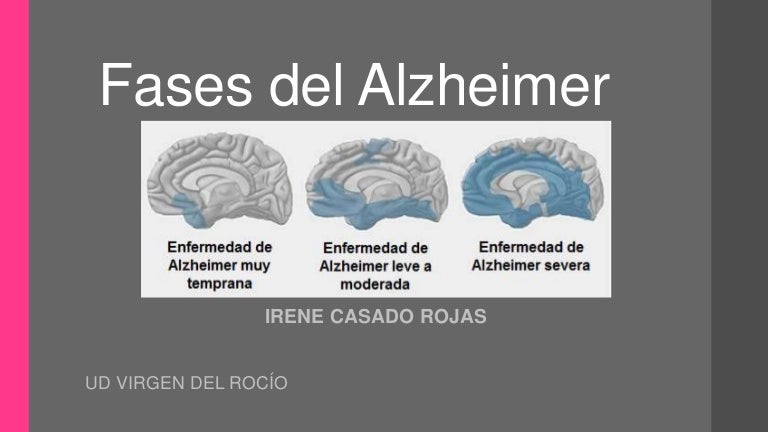 Fases Del Alzheimer