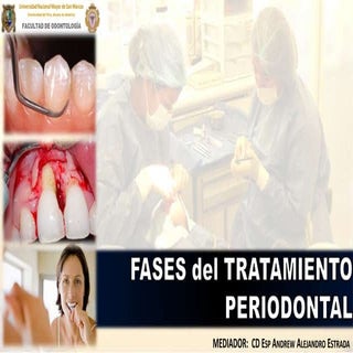 Fases del tratamiento periodontal | PPTX