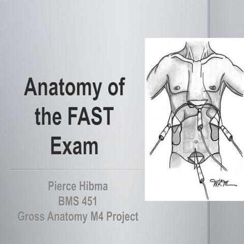 E-Fast Examination | PPTX