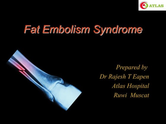 Fat embolism | PPT | Lung and Respiratory Health | Diseases and Conditions