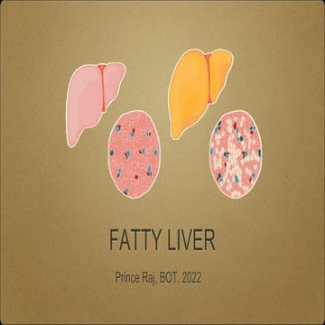 Fatty liver .pptx