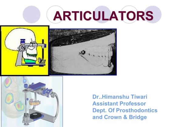 Hanau Wide Vue II Articulator | PPTX