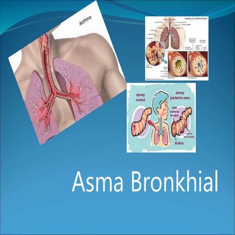 fdokumen.com_penyuluhan-asma.ppt