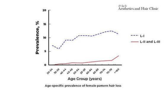 Female hair loss vs Male hair loss | Dr Tyng Tan Aesthetics and Hair ...