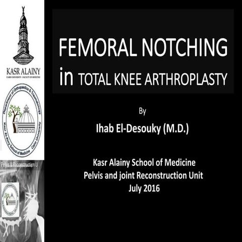 Femoral notching in total knee arthroplasty | PPTX | Bone and Joint ...