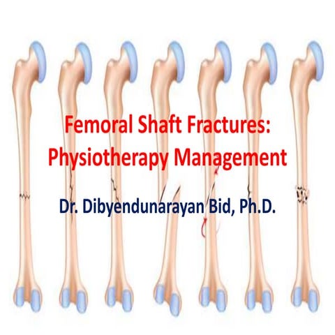PT Management of Fractures of Condyles of Femur | PPTX