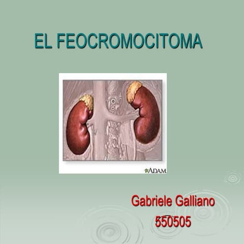 Feocromocitoma | PPT