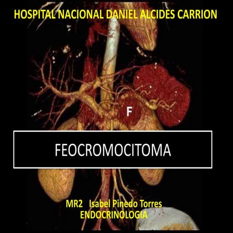 Feocromocitoma | PPTX