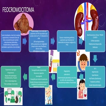 FEOCROMOCITOMA.pptx