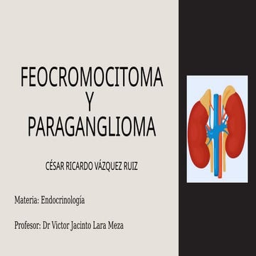 Feocromocitoma y Paraganglioma / Cesar Vazquez | PPTX