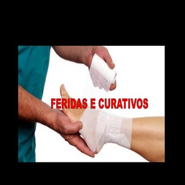 tipos de feridas e curativos cuidados.pdf