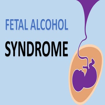 Fetal alcohol syndrome PPT.pptx