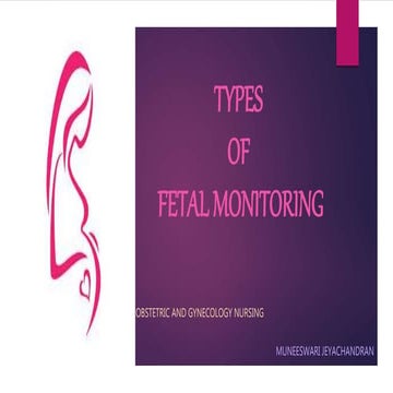 Types of Fetal monitoring | PPTX