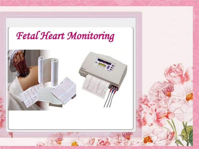 Electronic fetal monitoring. ppt | PPT