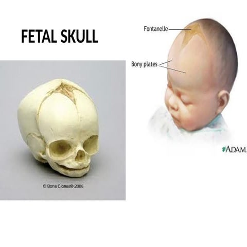 FETAL SKULL INCLUDING BONES AND DIAMETERS | PPTX