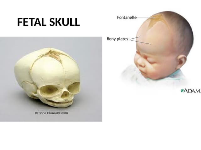Fetal skull ppt | PPTX