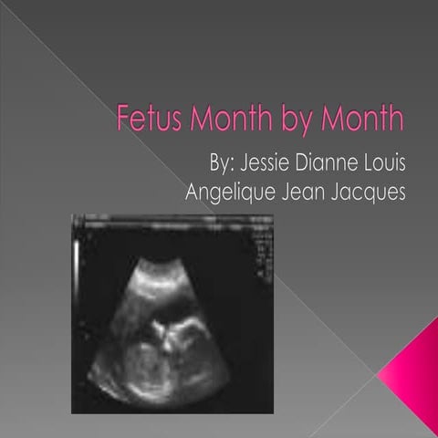 Fetus month by_month2 | PPTX