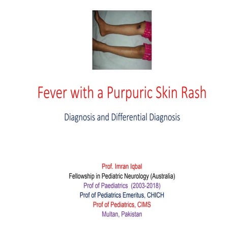 Fever with a purpuric skin rash in children 2021 | PDF