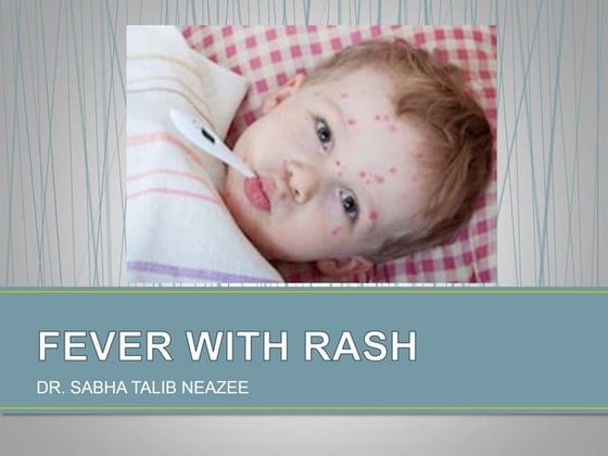Fever with rash | PPT
