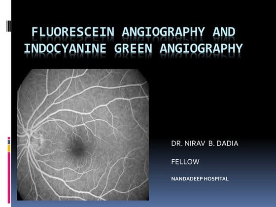 Indocyanine Green Angiography (ICG) | PPTX | Eye and Vision Conditions ...