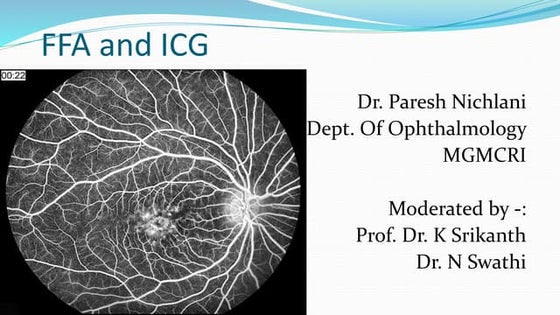Indocyanine Green Angiography (ICG) | PPT