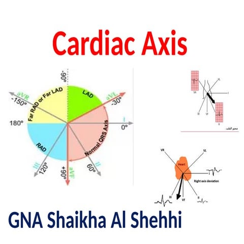 Cardiac axis abnormalities in ECG | PPTX